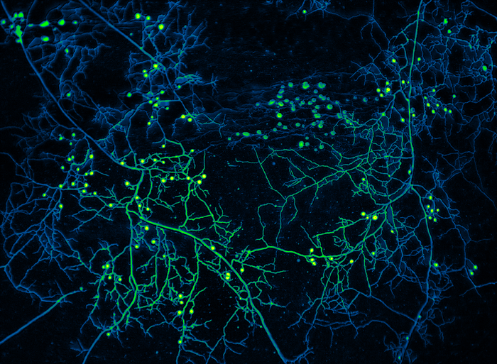 An Amazing Underground Network – Mycorrhizal Fungi Mapped for the First ...